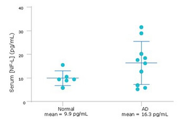 SMC® Human NF-L High Sensitivity Immunoassay Kit | 03-0202-00